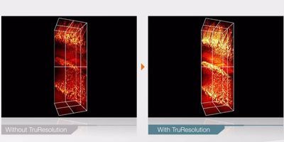 Deep-Tissue Imaging News, Articles | Lab Manager