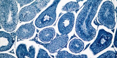 Blood Analysis News, Articles | Lab Manager