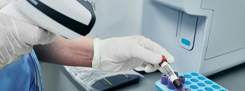 Advanced Sample Identification and Labware Preparation | Lab Manager