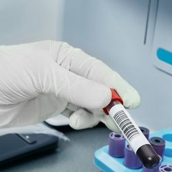 Laboratory Cleaning - Know Your Options for Cleaning Labware | Lab Manager