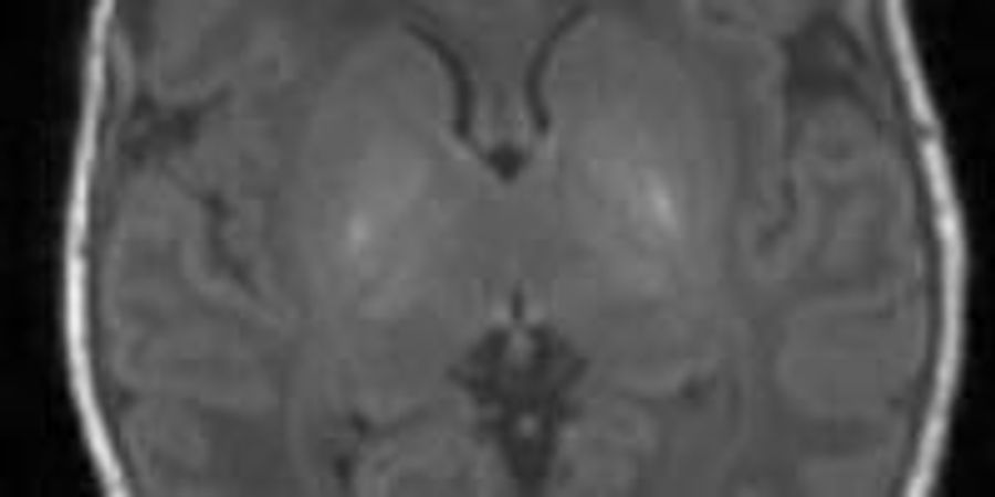 A 15-Minute Scan Could Help Diagnose Brain Damage in Newborns | Lab Manager